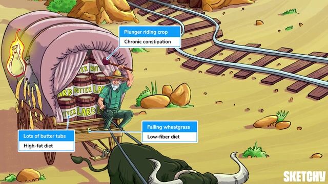 Acute Diverticulitis - Free Sketchy Medical Lesson