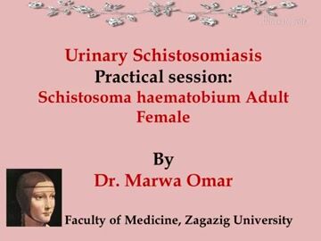 Schistosoma haematobium Adult Female Demonstration | Encyclopedia MDPI