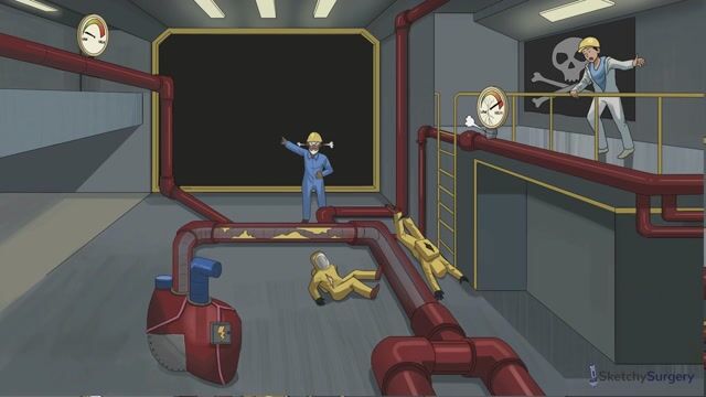 Aortic Dissection - Free Sketchy Medical Lesson