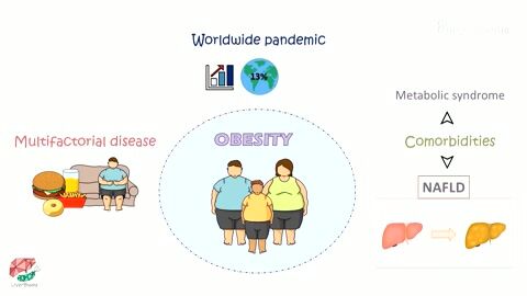 Childhood Obesity | Encyclopedia MDPI