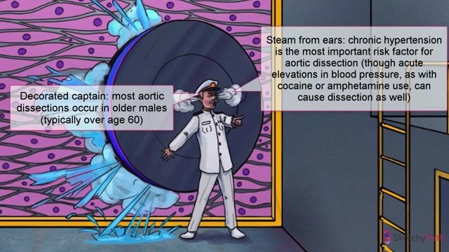 Aortic Dissection - Free Sketchy Medical Lesson