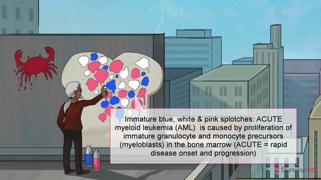 Acute Myeloid Leukemia (AML) & Chronic Myeloid Leukemia (CML) - Free ...