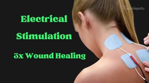 Electrical Stimulation Triples Wound Healing Speed | Encyclopedia MDPI