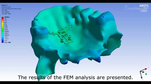 Skeletal Anchorage Using Biomechanical Modeling | Encyclopedia MDPI
