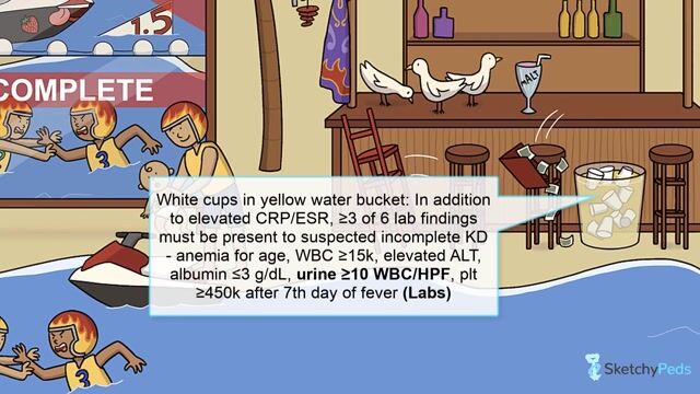 Kawasaki Disease SOAP Part 2 - Free Sketchy Medical Lesson