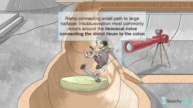 Intussusception SOAP - Free Sketchy Medical Lesson