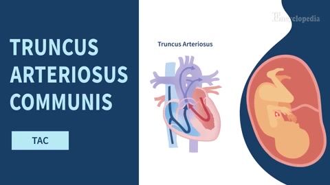 Diagnosis, Management, and Outcomes in Fetal Truncus Arteriosus ...