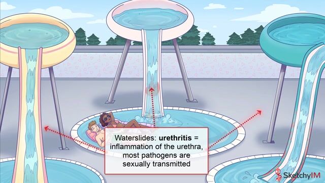 Urethritis in Males - Free Sketchy Medical Lesson