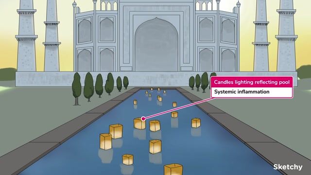 Rheumatoid Arthritis - Free Sketchy Medical Lesson