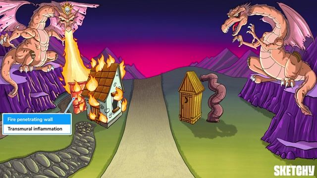 Inflammatory Bowel Disease: Crohn's Disease & Ulcerative Colltis - Free ...