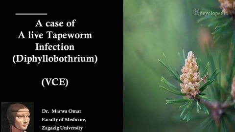 A Live Fish Tapeworm by VCE | Encyclopedia MDPI