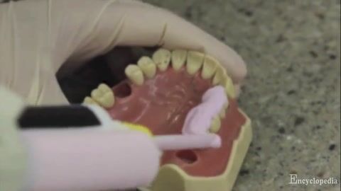 Novel Techniques for Pinlays | Encyclopedia MDPI